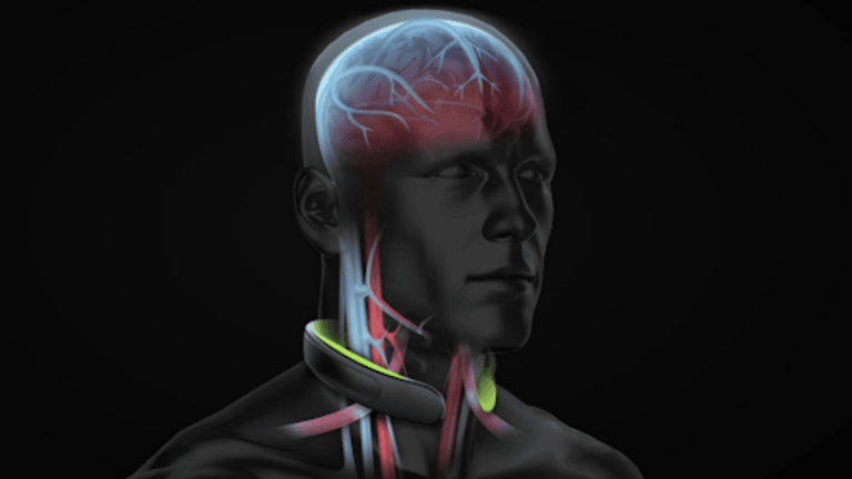 The Q-Collar Explained: Could a Necklace Prevent Concussions? – OneResearch